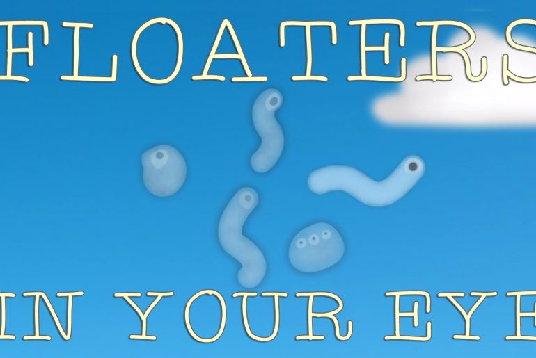 Eye Floaters: Is there a Natural Remedy to Get Rid of Them?