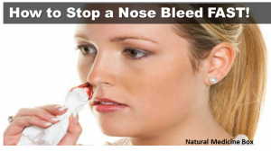 How to Stop a Nose Bleed FAST!